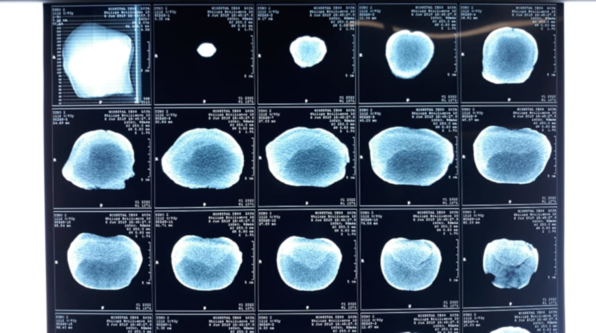 De piedra a fósil, la historia tras el hallazgo del Yamanasaurus