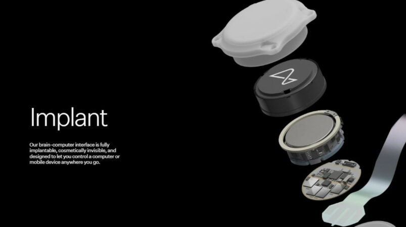 'Telepathy': ¿Qué es y cómo funciona el chip cerebral de Musk?
